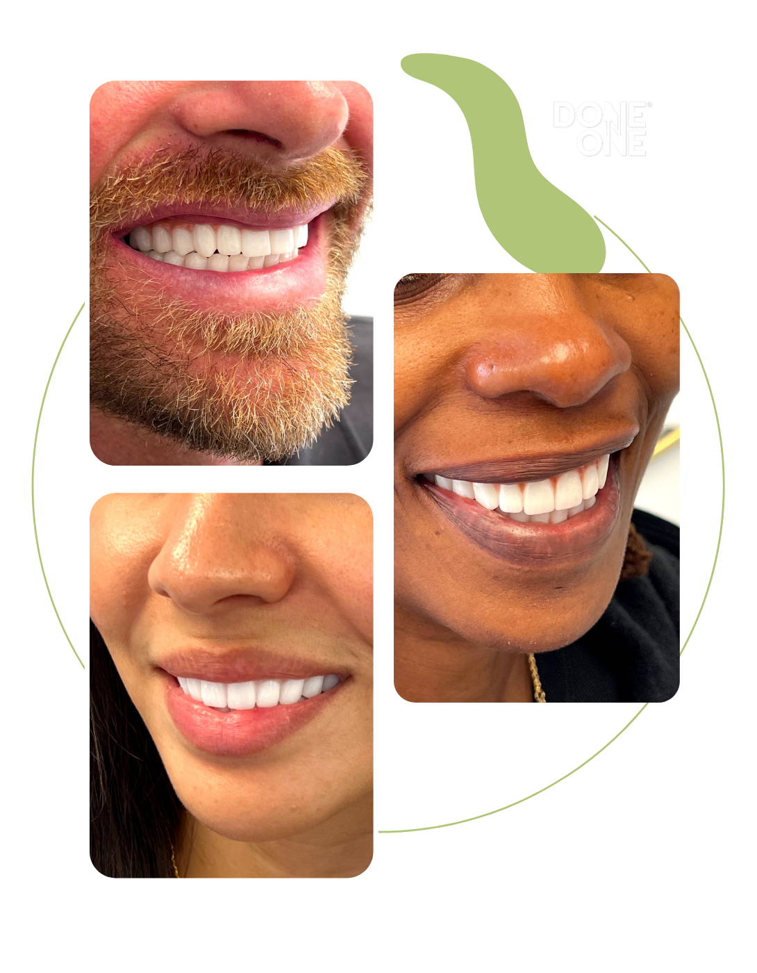 Done In One Dental Implant Center - Zirconia Teeth in 7 Days